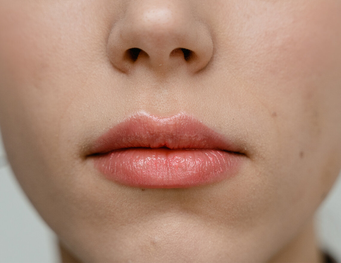 Tout savoir sur les boutons sur le menton – Dr Pierre Ricaud